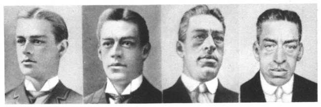 Os dias agoniantes de Adam Rainer, o anão que virou gigante - Aventuras ...